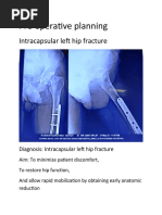 Stryker Exeter V40 Surgical Guide | PDF | Hip | Musculoskeletal System