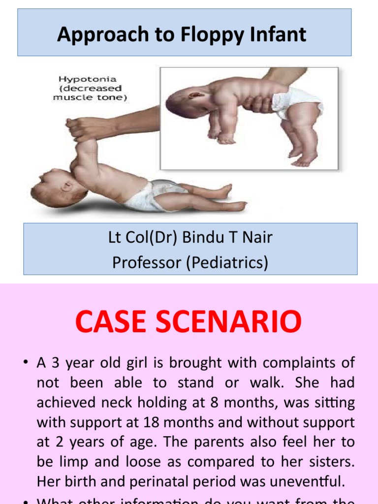 Approach To Floppy Infant: LT Col (DR) Bindu T Nair Professor ...