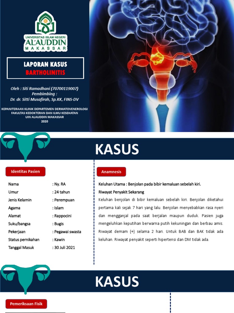 Kasus Bartholinitis: Diagnosis dan Penanganan | PDF