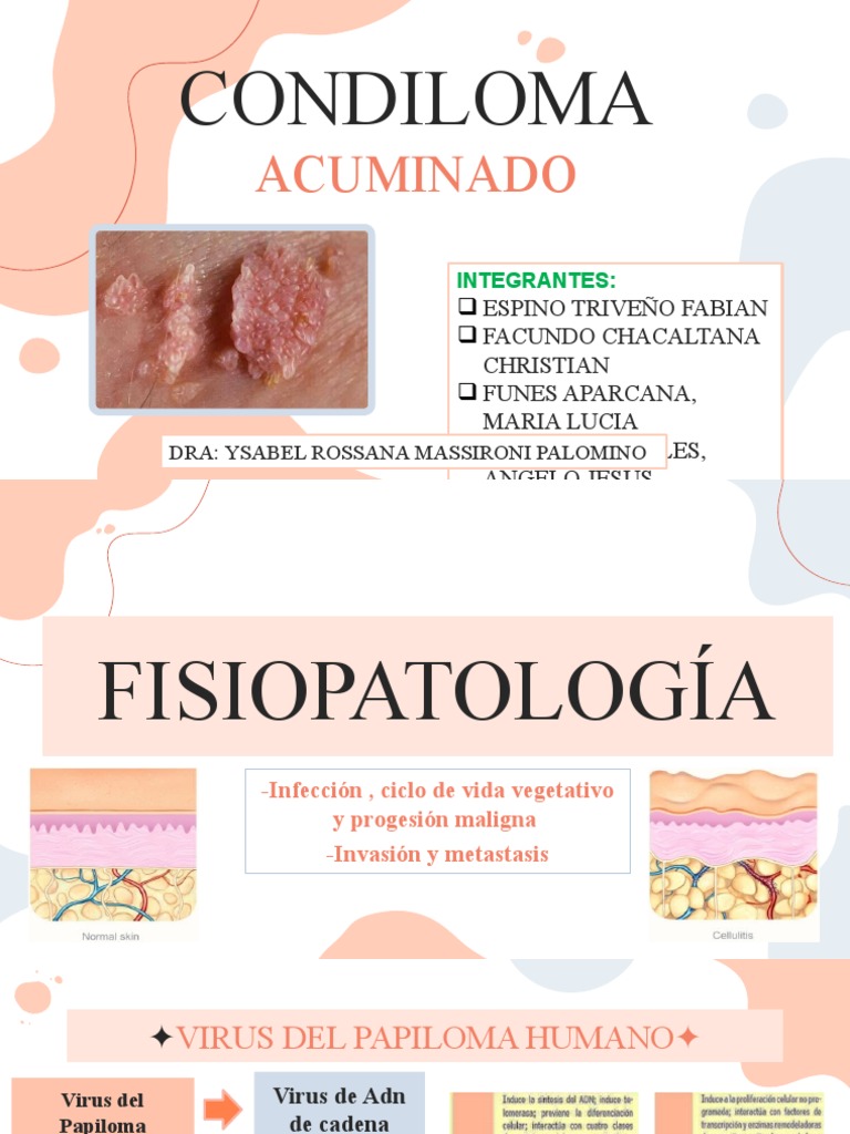 Caso Clinico - Condiloma Acuminado | PDF | Enfermedades y trastornos ...