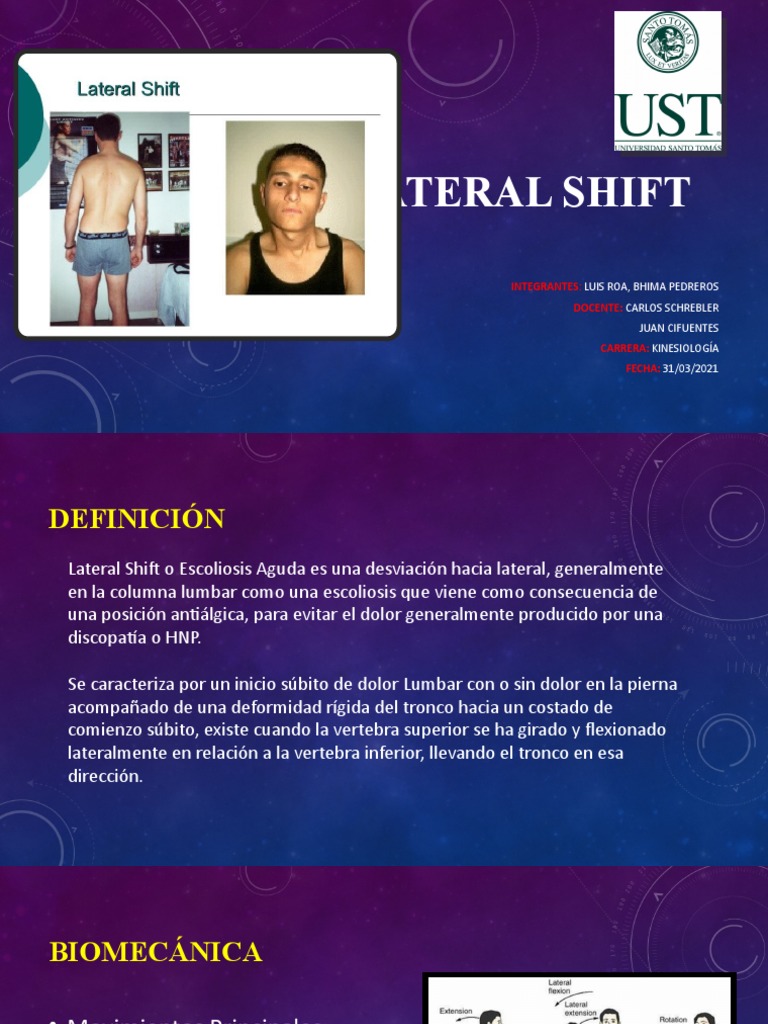 Lateral sHIFT | PDF | Escoliosis | Vértebra