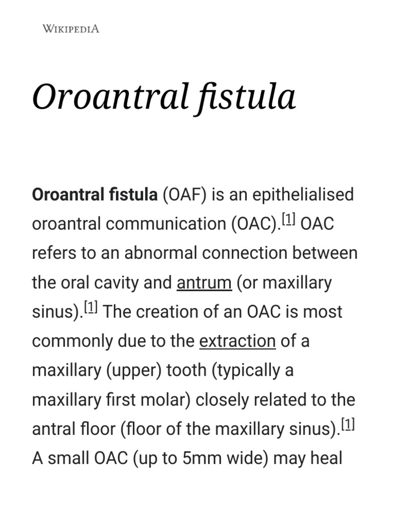 Oroantral Fistula - Wikipedia | PDF | Mouth | Anatomy