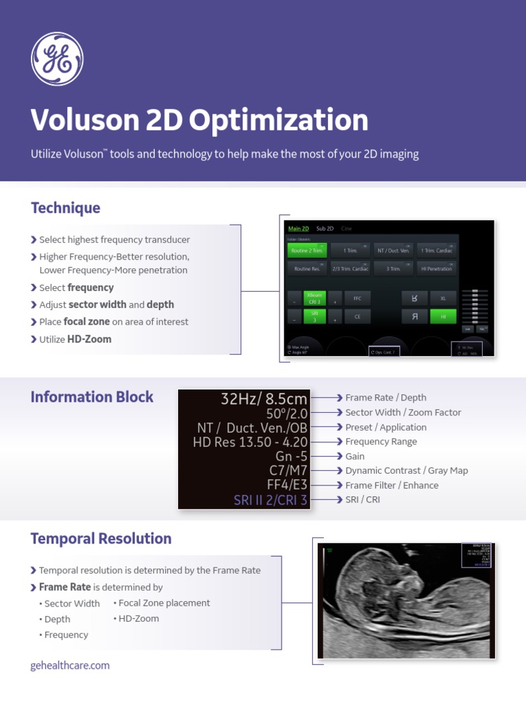 Voluson 2D Optimization: Technique | PDF | Medical Imaging | Optics