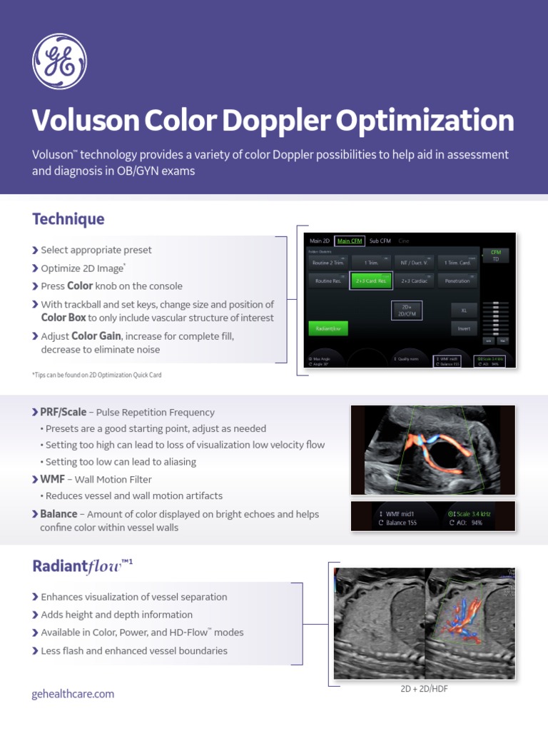 Voluson Color Doppler Optimization: Technique | PDF | Signal Processing ...