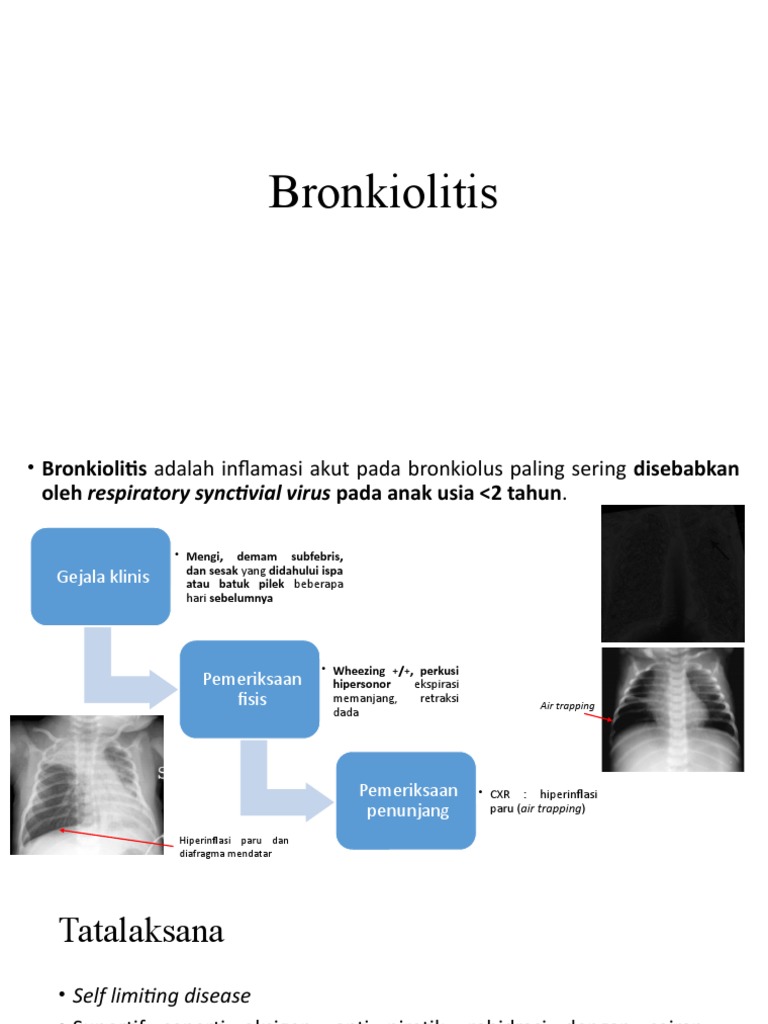 Bronkiolitis | PDF