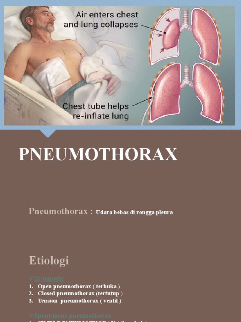 Penatalaksanaan Open Pneumothorax | PDF