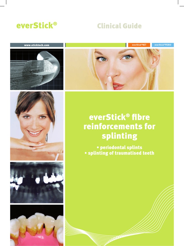 Everstick Splints | PDF | Periodontology | Composite Material