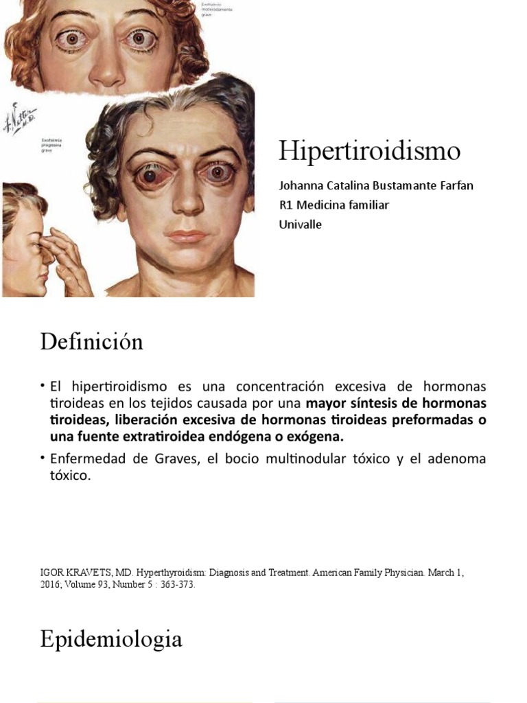 Hipertiroidismo | PDF | Tiroides | Hormona estimulante de la tiroides
