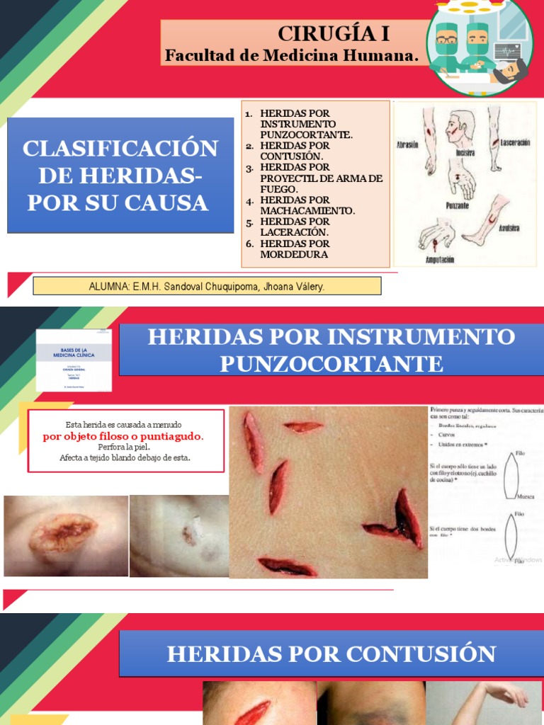 Clasificación de Las Heridas-Seminario I | PDF | Herida | Enfermedades y trastornos humanos