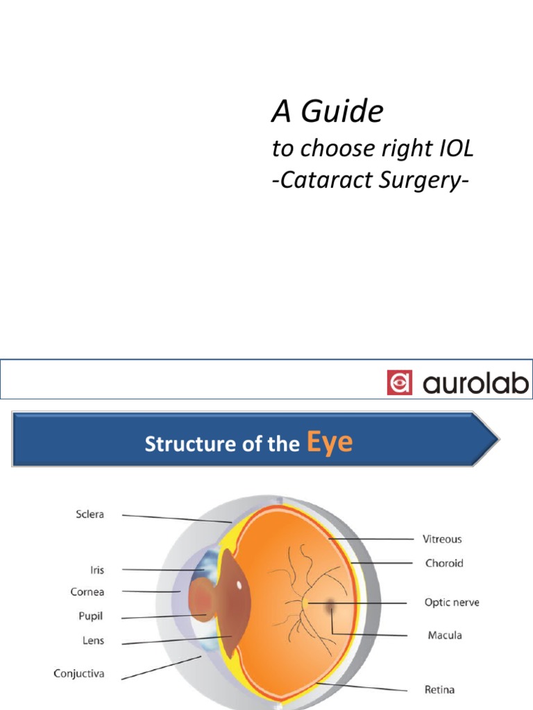 A Guide: To Choose Right IOL - Cataract Surgery | PDF | Human Eye | Lenses