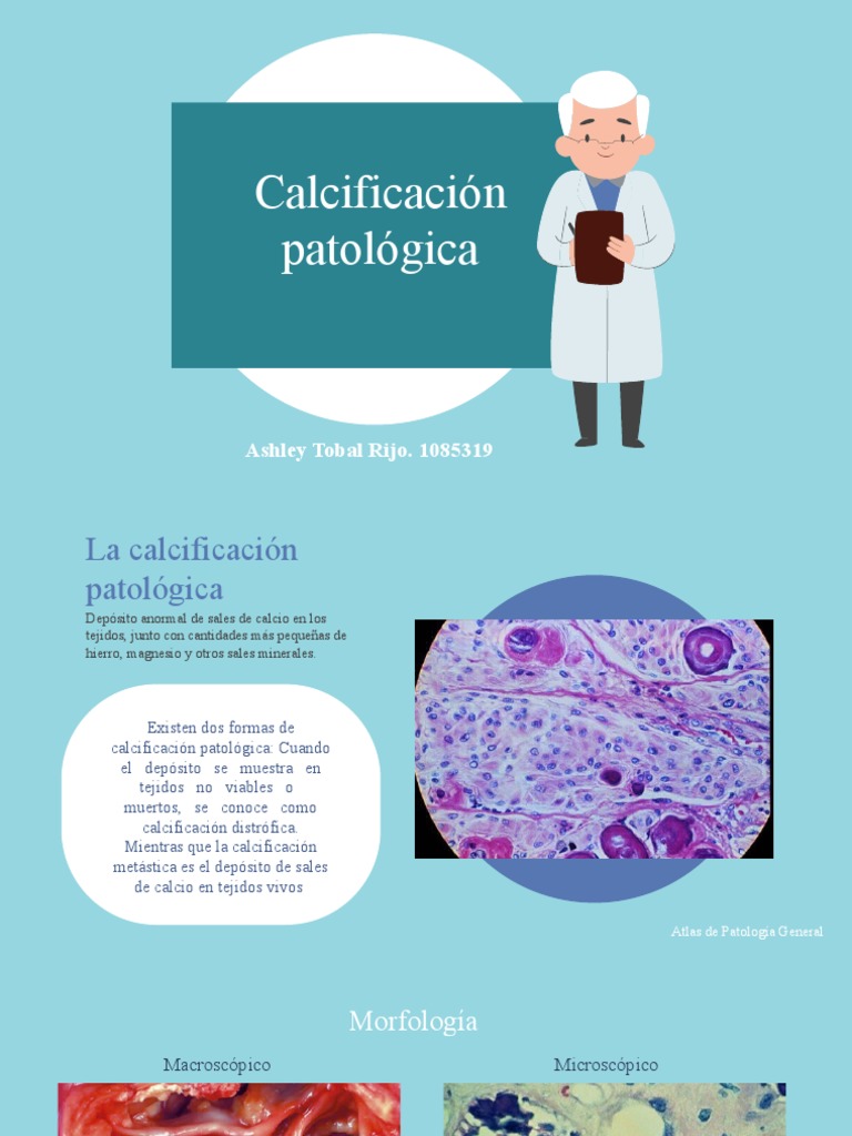 Calcificación | PDF | Calcio | Biología