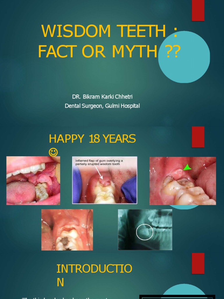 WISDOM TEETH FACTS AND MYTHS | PDF | Tooth | Clinical Medicine