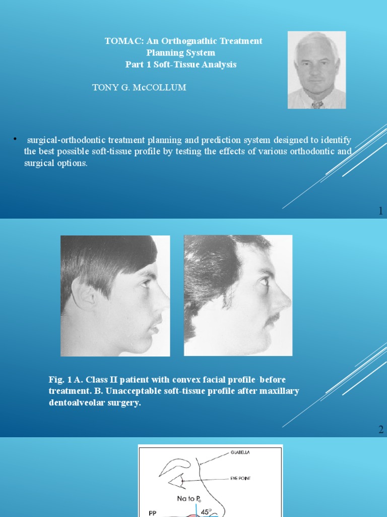 TOMAC: An Orthognathic Treatment Planning System Part 1 Soft-Tissue ...