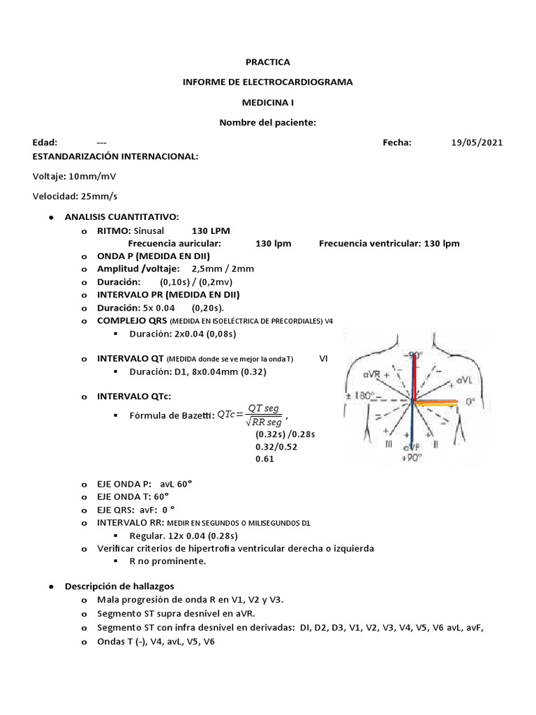Informe de Electrocardiograma Normal | PDF | Ciencia y matemáticas