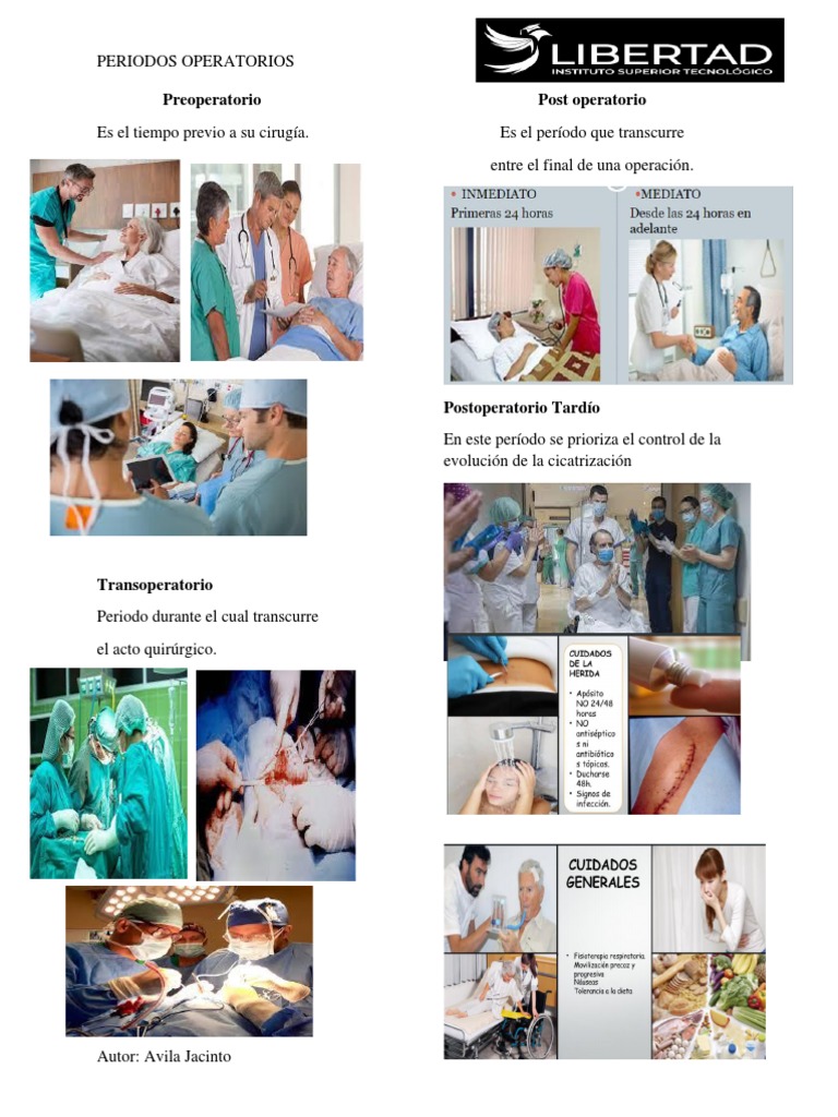 Periodos Operatorios | PDF