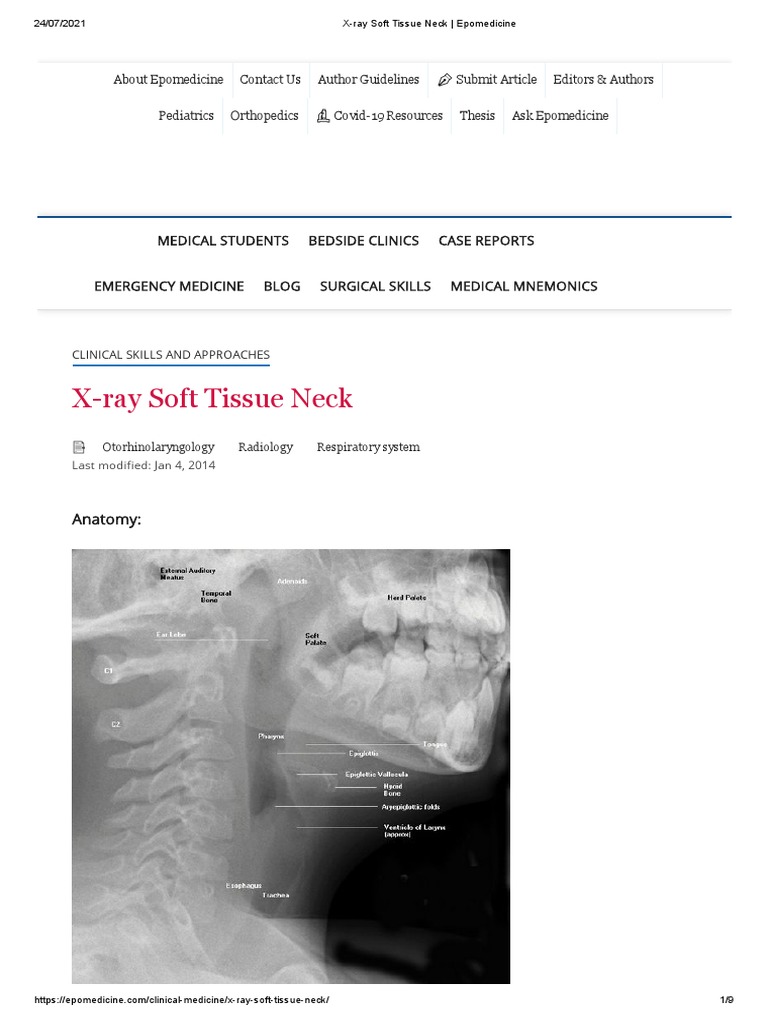 Soft Tissue Neck X-Ray Overview | PDF | Larynx | Neck