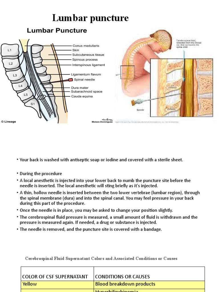 Lumbar Puncture | PDF | Cerebrospinal Fluid | Meningitis