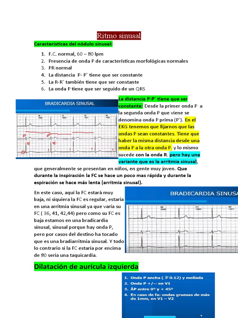 Ritmo Sinusal | PDF | Electrocardiografia | Medicina CLINICA