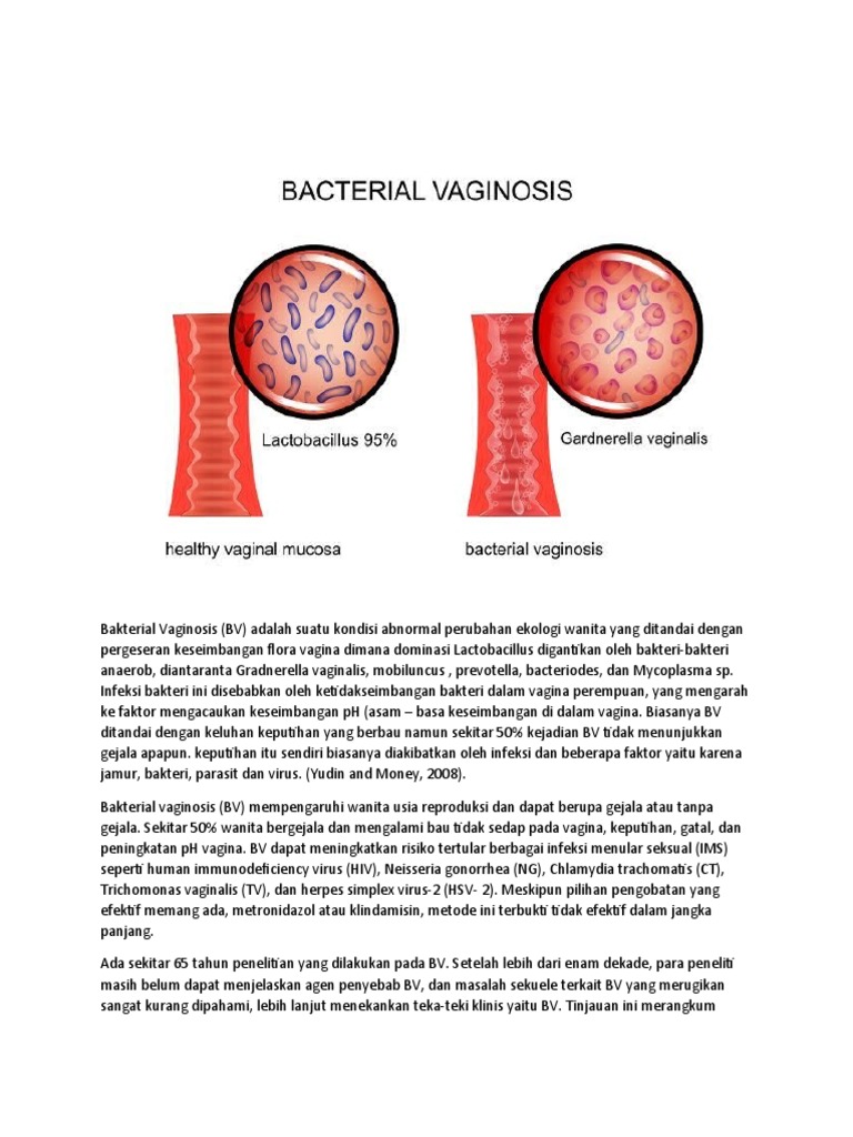 Bakterial Vaginosis | PDF