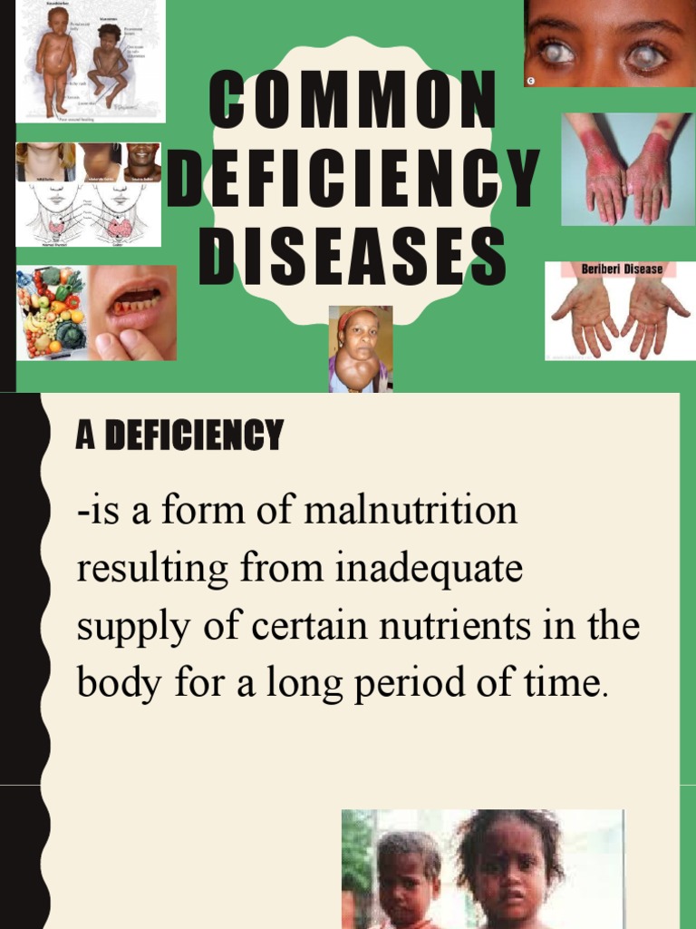 8-Common Deficiency Desease | PDF | Malnutrition | Vitamin