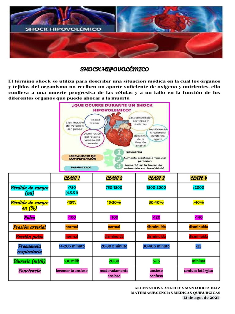 Shock Hipovolémico | PDF