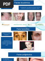Tipos de Facies en Medicina Clínica | PDF | Cara | Especialidades Medicas