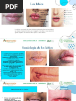 Anatomía y Límites de la Región Maseterina | PDF | Cabeza y cuello ...