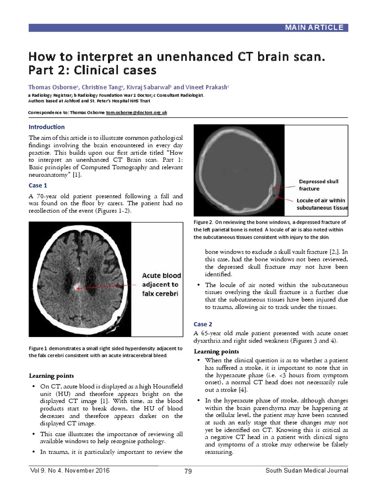 How to interpret CT brain scans | PDF | Stroke | Ct Scan