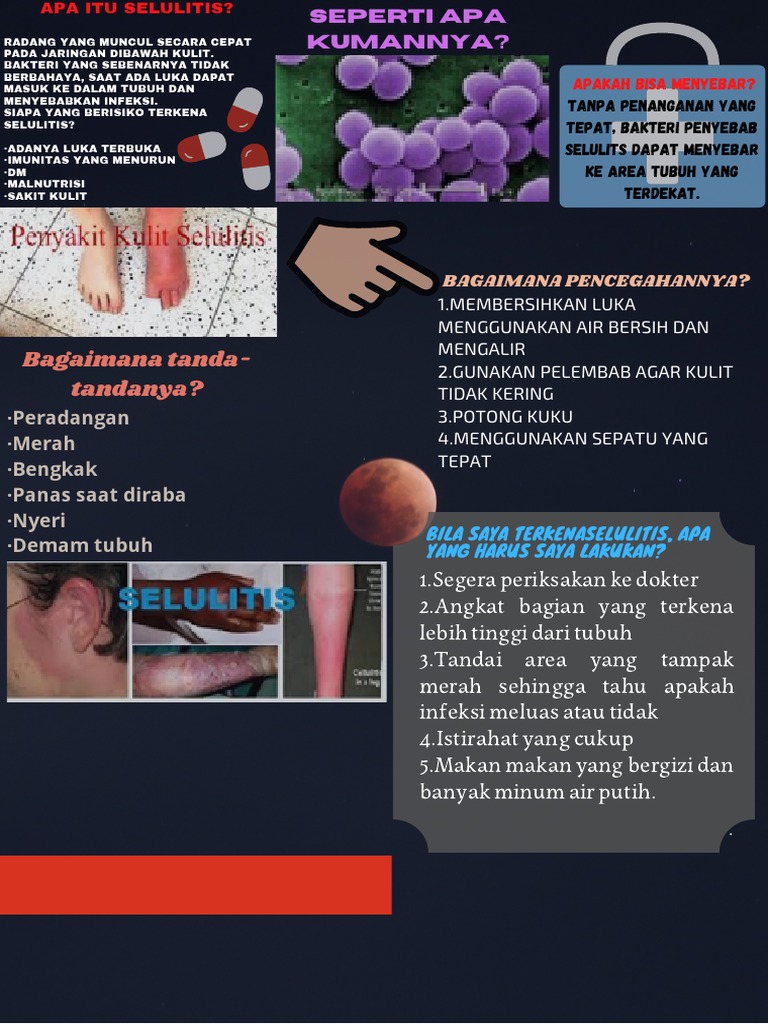 DIDIN Leaflet Selulitis | PDF