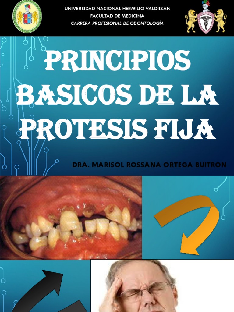 Clase 1 - Principios Basicos de La Protesis Fija | PDF | Dentadura ... Clase 1 - Principios Basicos de La Protesis Fija | PDF | Dentadura ...