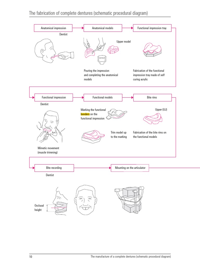 The Fabrication of Complete Dentures (Schematic Procedural Diagram ...