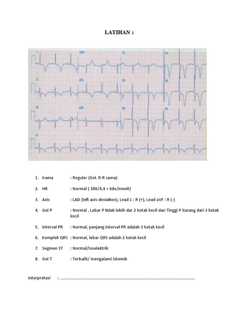 Soal Ekg Acs 2021 | PDF