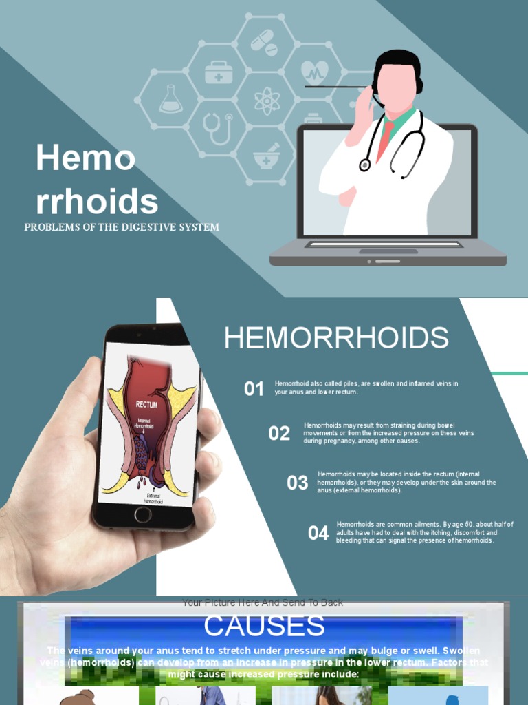 Hemorrhoids GRP 3 | PDF | Hemorrhoid | Digestive System