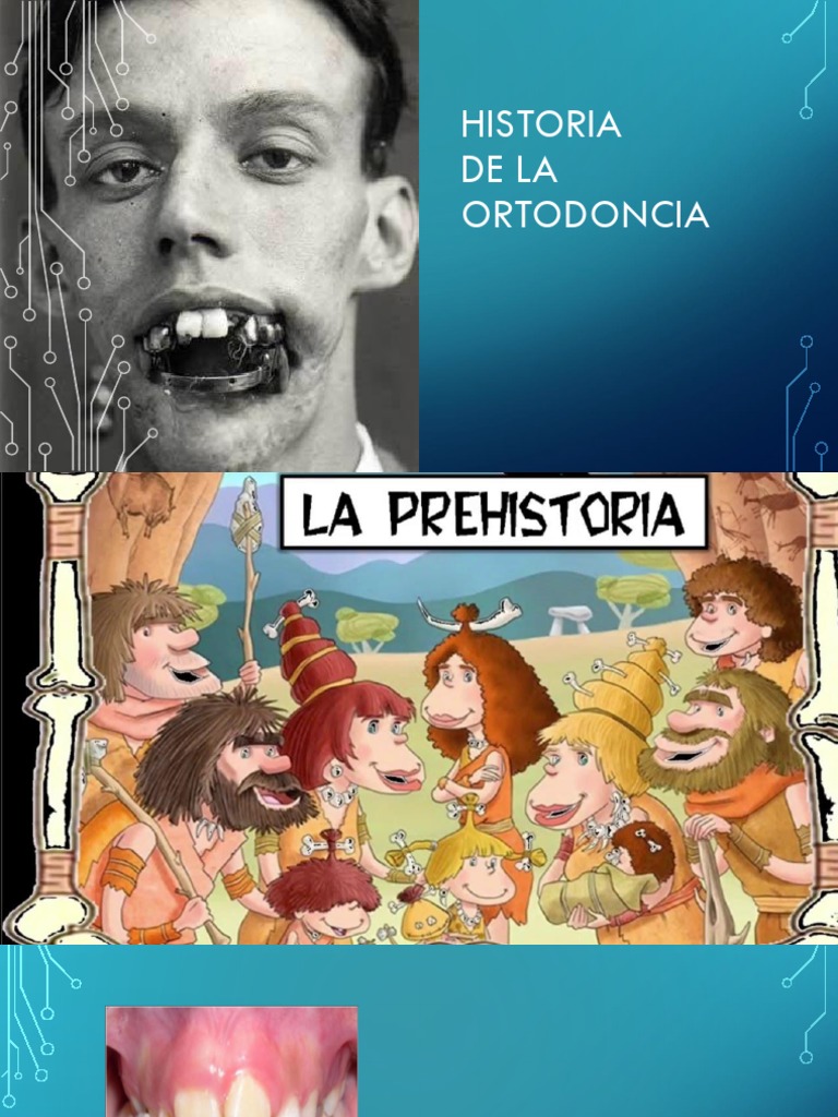 Historia de La Ortodoncia | PDF
