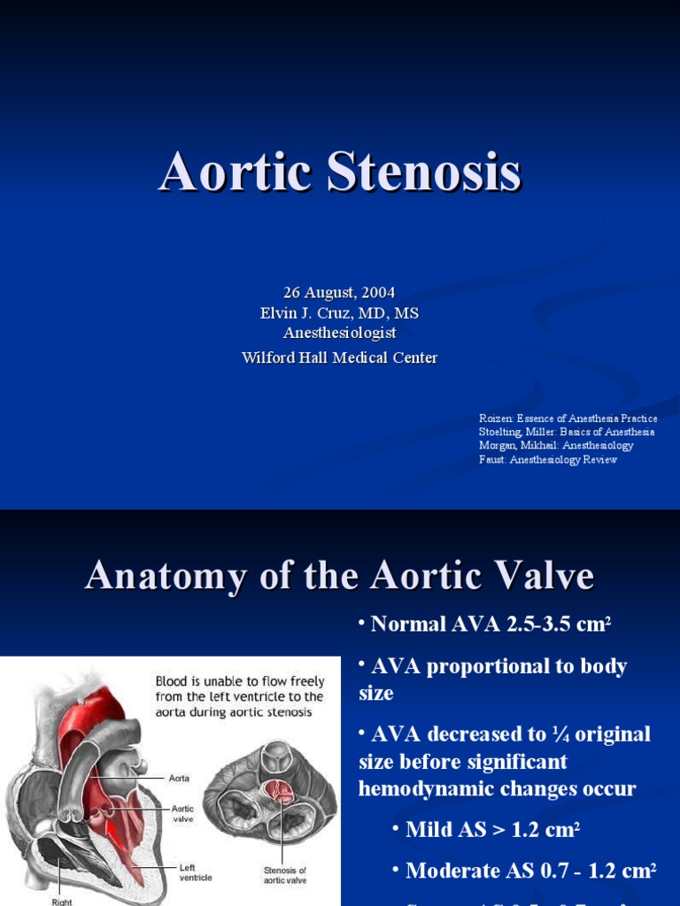 Aortic Stenosis | PDF | Clinical Medicine | Physiology