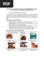 Líneas de Terminación | PDF | Dentadura postiza | Diente