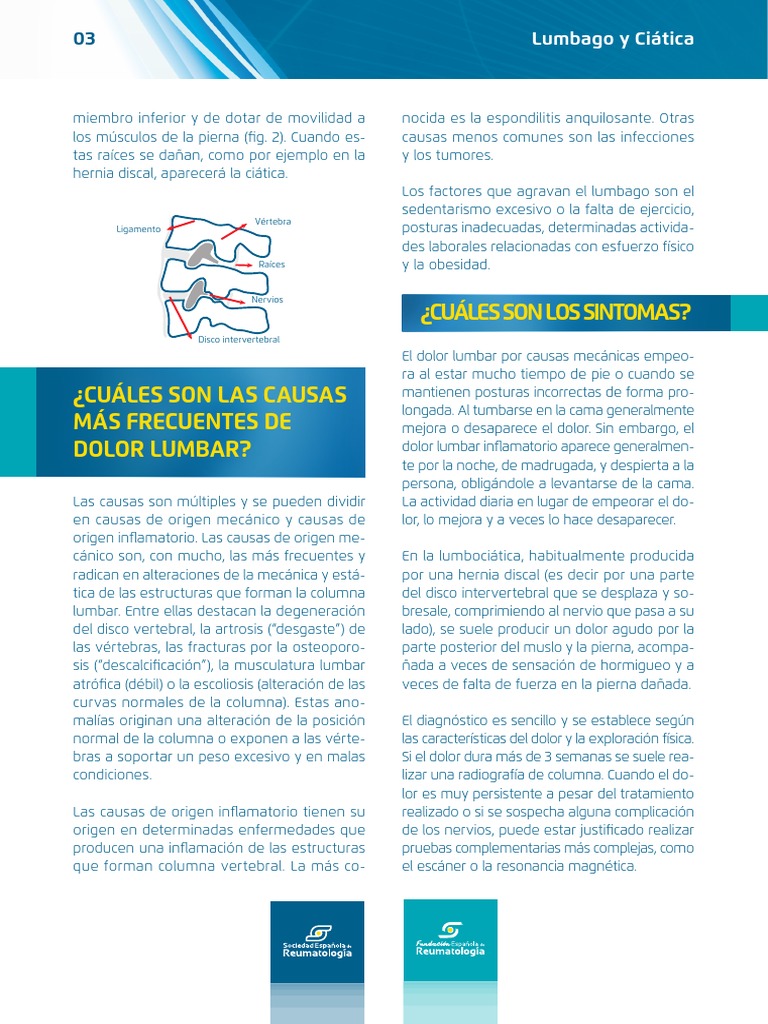 Lumbago y Ciática: Causas y Tratamientos | PDF | Dolor lumbar ...