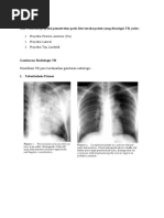 Gambaran Radiologi Tuberkulosis Paru | PDF