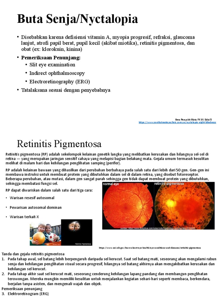 Buta Senja | PDF | Sains & Matematika