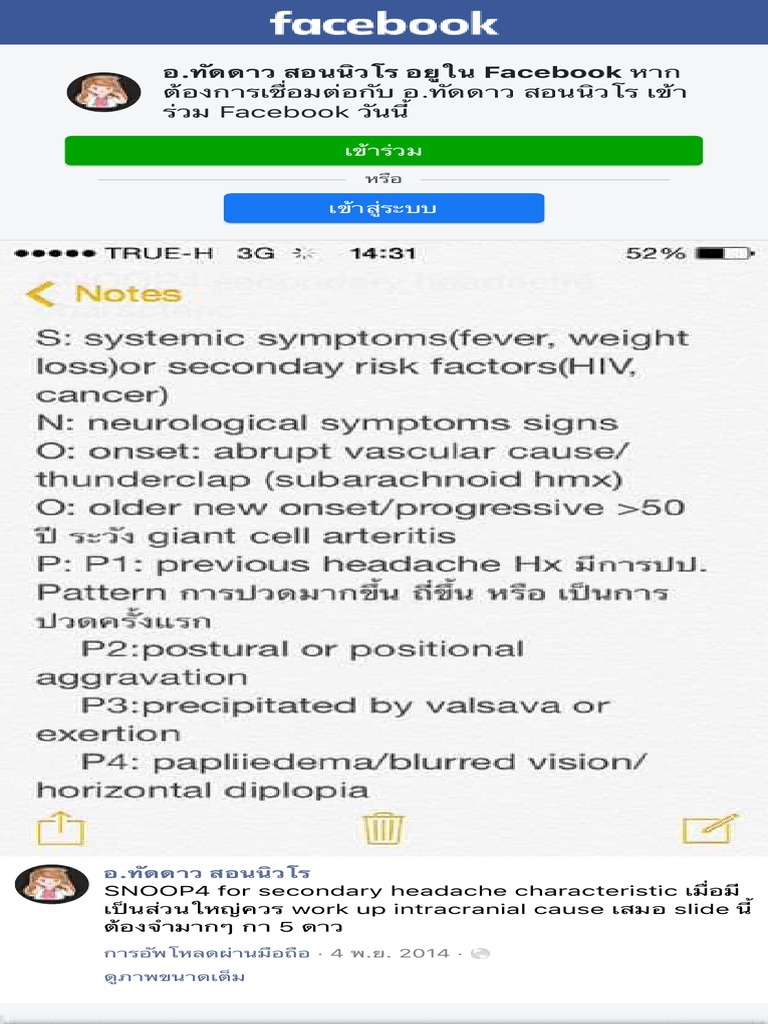 อ.ทัดดาว สอนนิวโร - SNOOP4 for secondary headache characteristic เมื่อ ...