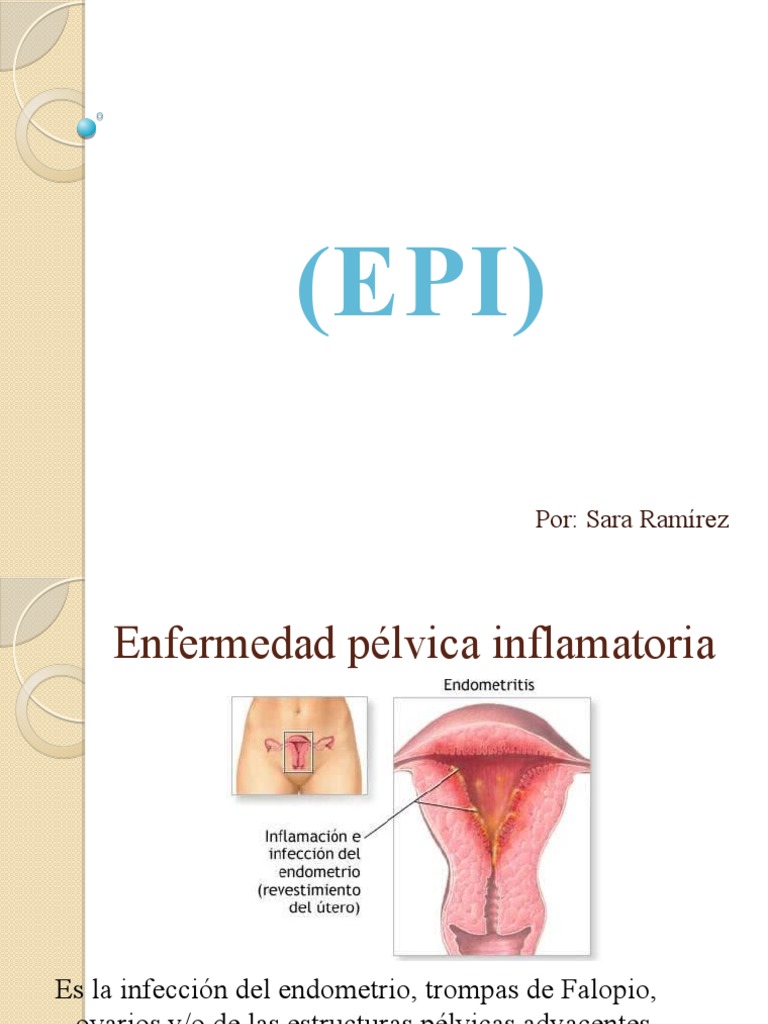 Enfermedad pélvica inflamatoria (EPI)