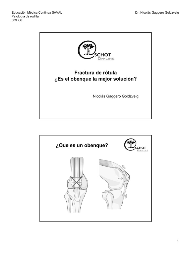 Fracturas de Rotula | PDF | Rodilla