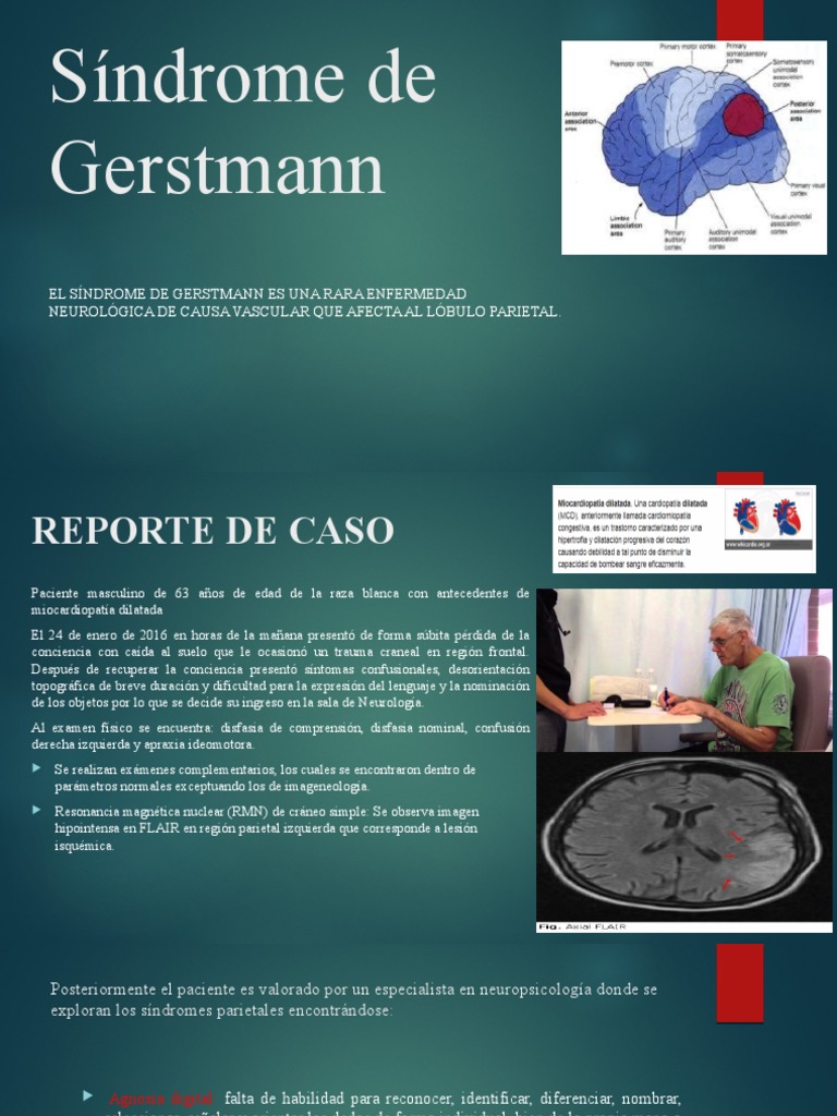 Caso clínico del síndrome de Gerstmann | PDF | Neuropsicología | Afasia