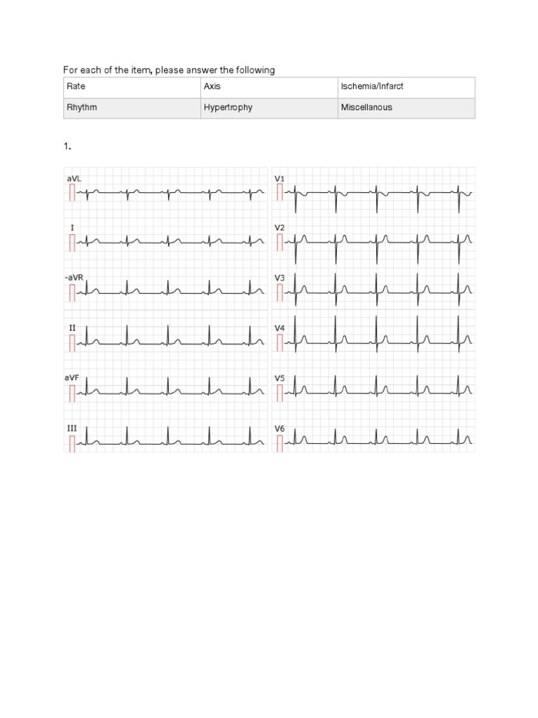 Practice Basic Ecg | PDF