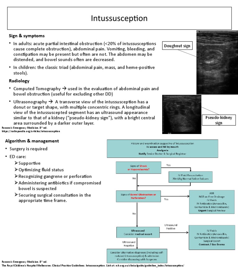 Intussusception Claw Sign