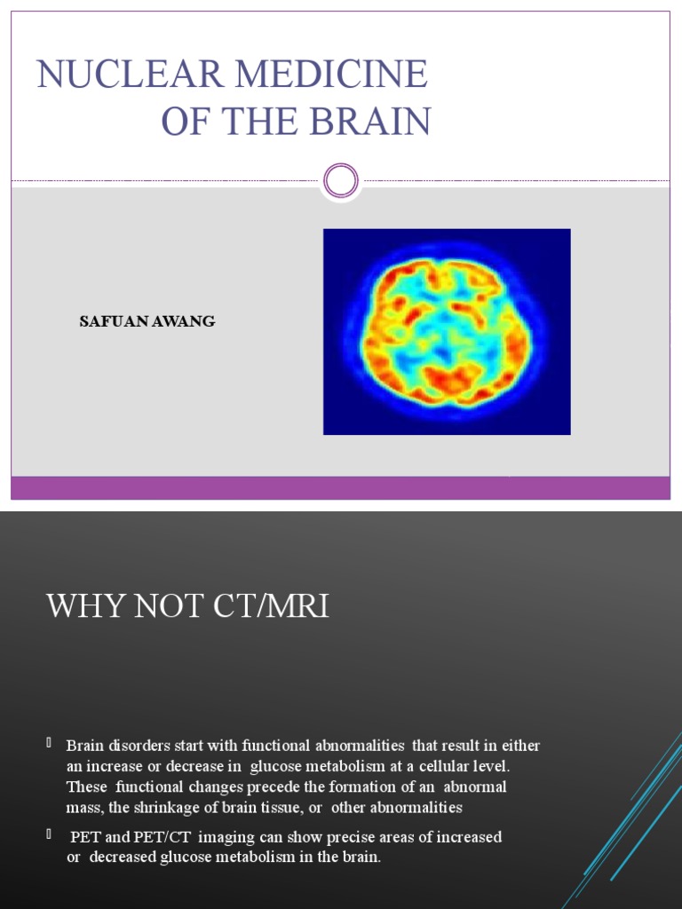 Nuclear Medicine of The Brain: Safuan Awang | Download Free PDF ...
