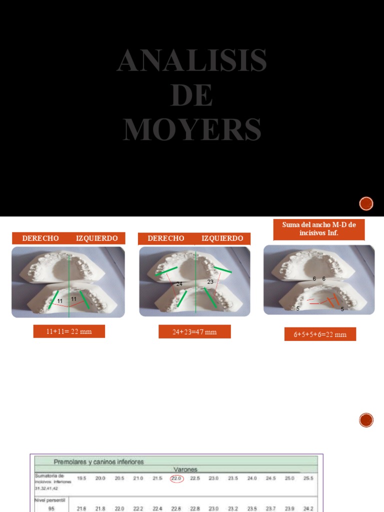 ANALISIS Moyers | PDF | Anatomia dental | Boca