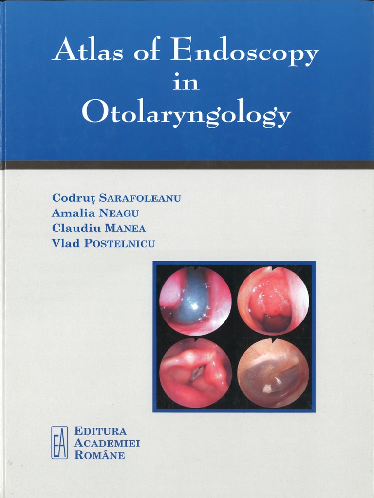 Atlas of Endoscopy in ORL | PDF