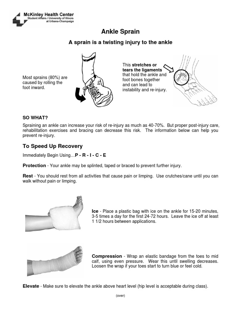 Ankle Sprain: A Sprain Is A Twisting Injury To The Ankle | PDF | Lower ...