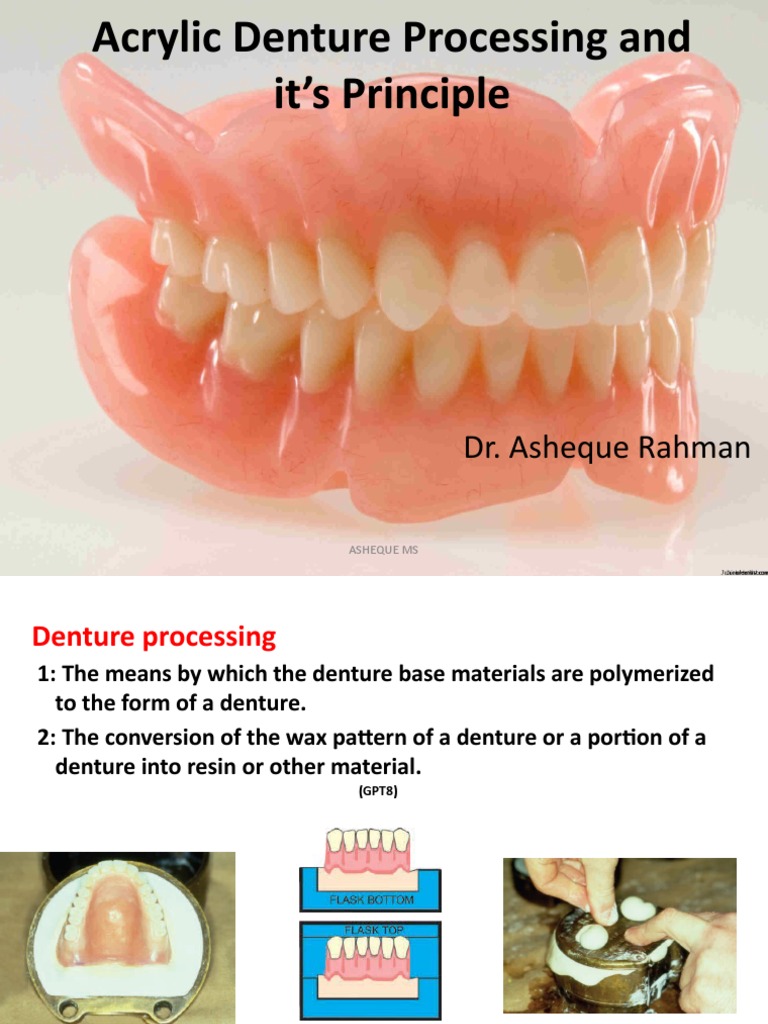 Denture Processing | PDF | Dentures | Plaster